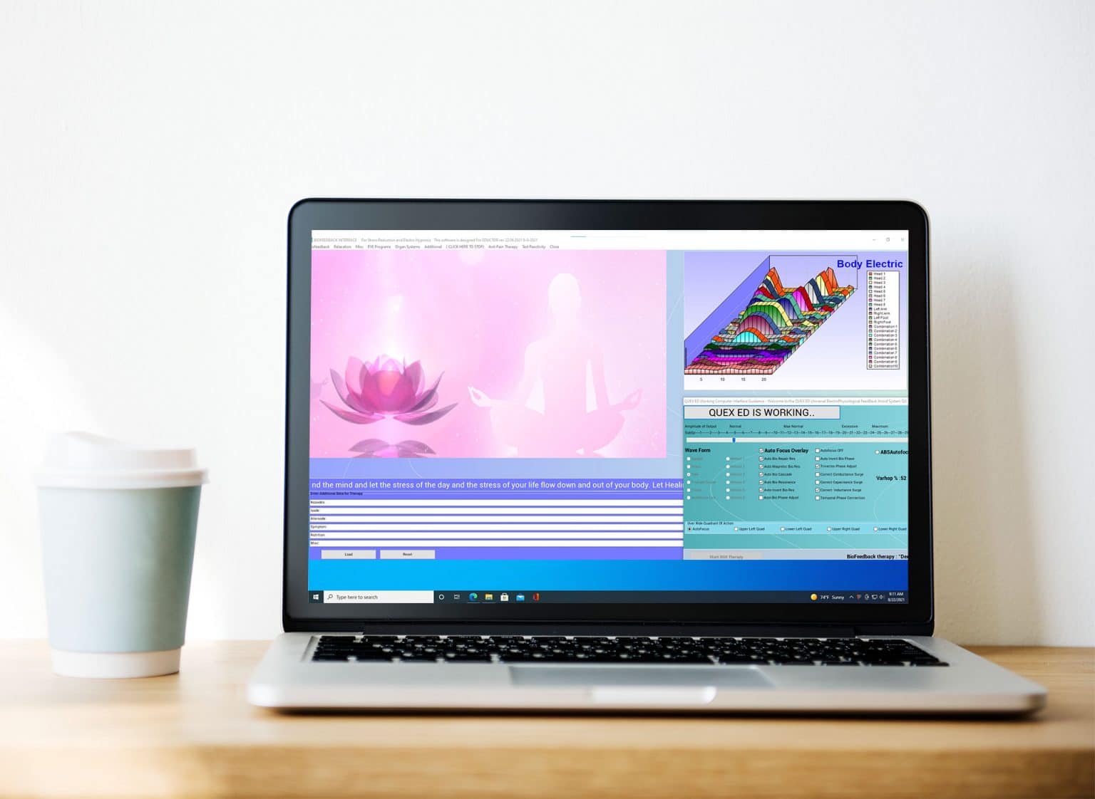 Omnis Software Update - Latest Features and Improvements